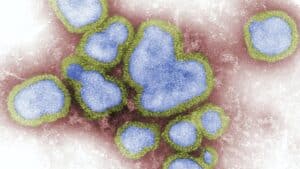 Here’s What Happens When You Take Zicam - Historic Health